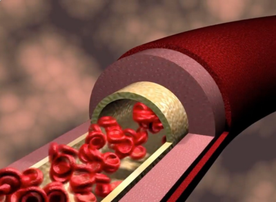 How AVACEN Works | Microcirculation & Pain Relief Explained